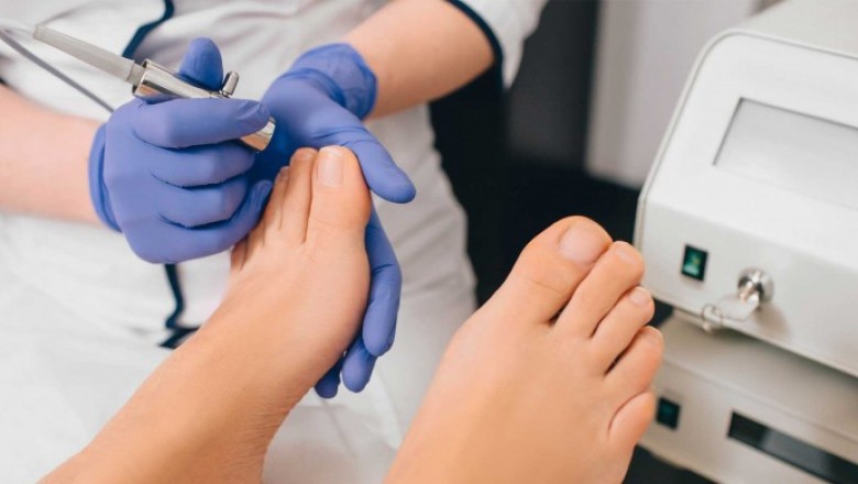 what is toenail fungus and how to treat | Brass Kangaroo